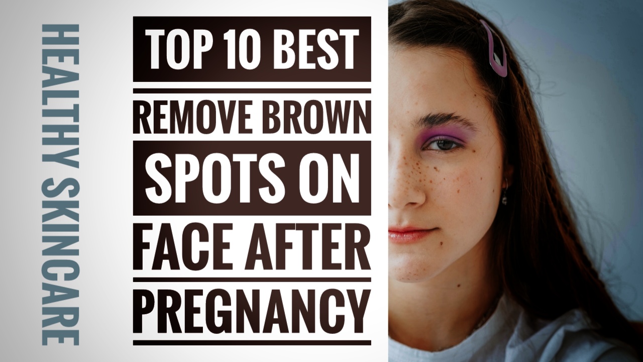10 BEST METHODS TO REMOVE FACIAL BROWN SPOTS AFTER PREGNANCY